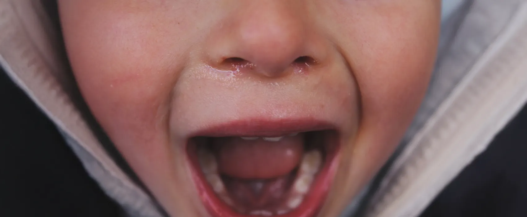 7 Signs You Should Talk to the Doctor About a Screaming Toddler